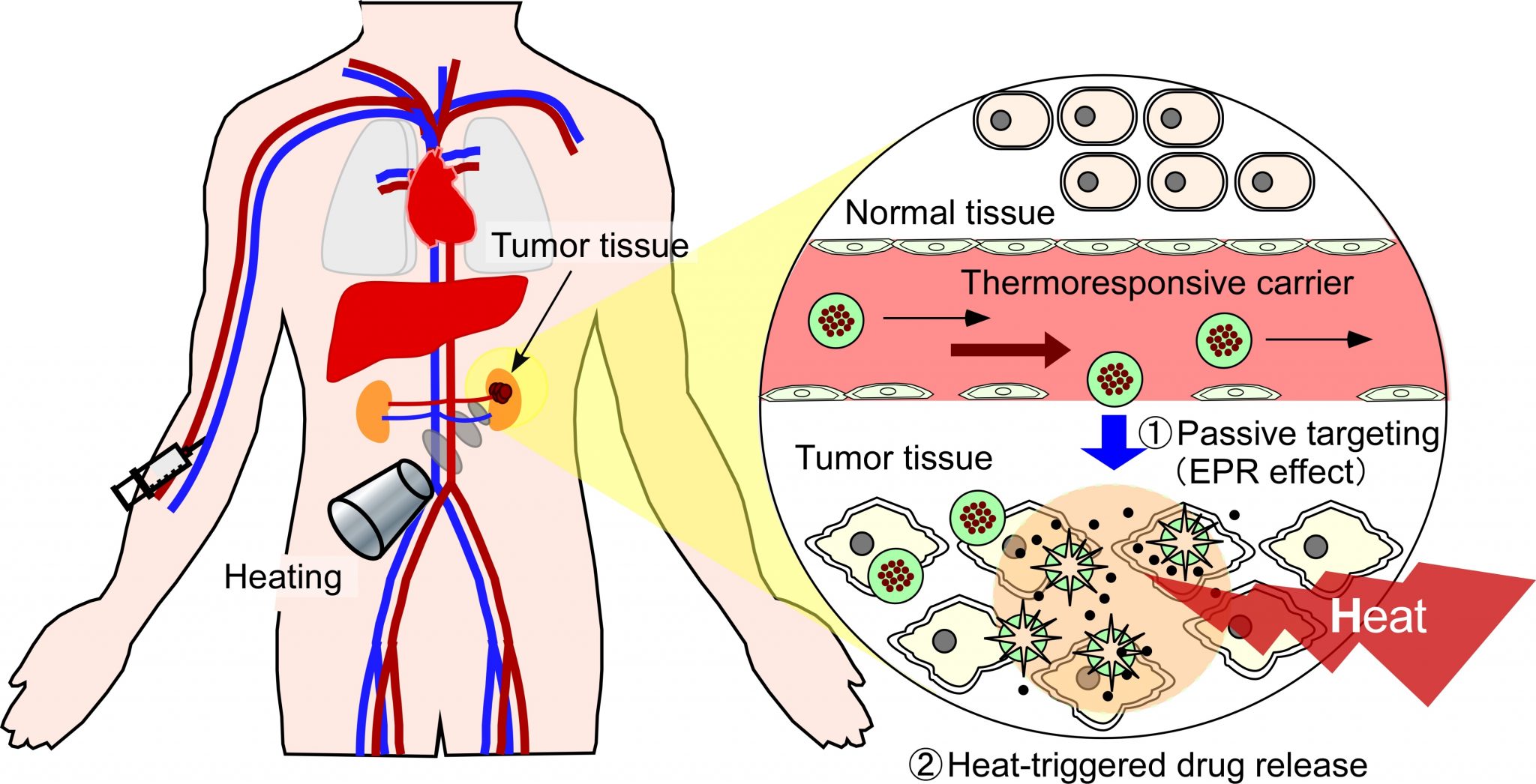 Polymeric micelle-drug carrier system | ABMES
